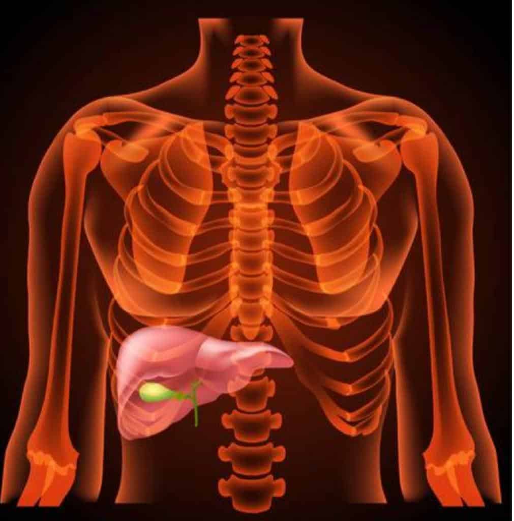 Indian Diet Plan For Gall Bladder Removal Surgery What To Eat After